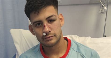 Recibió Una Patada En El Rostro Y Terminó En El Hospital La Violenta