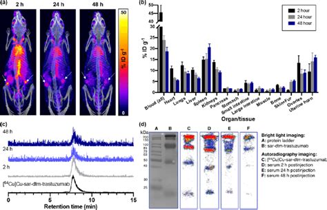 A PET CT Maximum Intensity Projections Of A Healthy Female NOD Scid