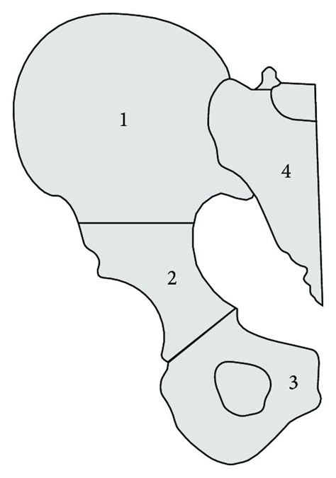 Anatomic Regions Of The Pelvis According To The Enneking Classification