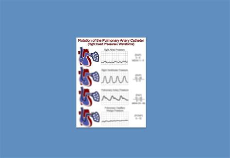 Pulmonary Artery Catheter Right Heart Pressures Waveforms Reference Sheet Cardiovue Etsy