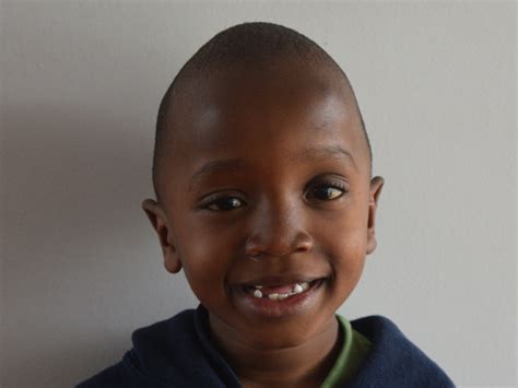 Success Mugisha From Tanzania Raised 838 To Fund Orthopedic Surgery