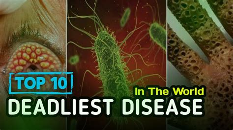 20 Deadliest Diseases In The World Youtube