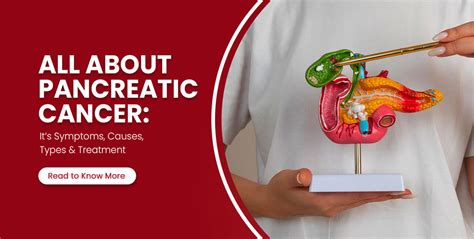 Understanding Pancreatic Cancer Symptoms Causes Stages And Treatment