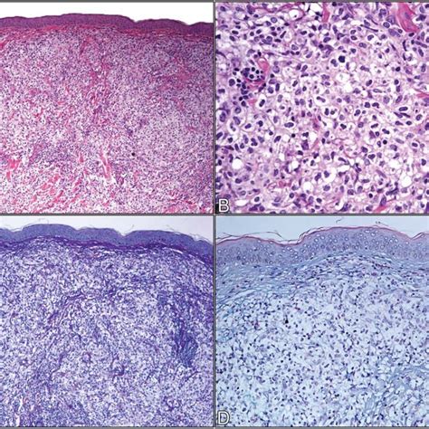 Morphological Features And Special Stains Hematoxylin And Eosin Hande