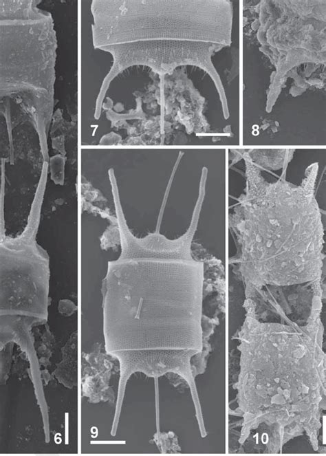 Odontella Longicruris Whole Cells Sem External Views Figs 6 10