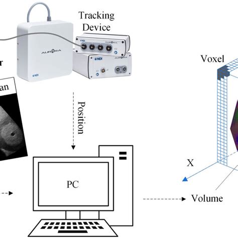 illustration of freehand ultrasound acquisition and relationship