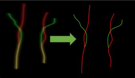 Centerlines Carotid Segmentation Documentation