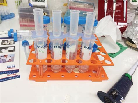 Test Tubes At The Universiti Putra Malaysia Biotechnology And