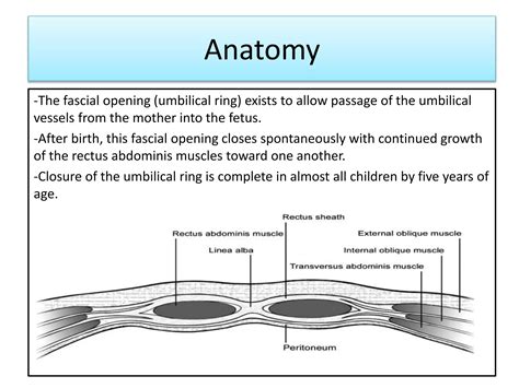 Umbilical Hernia Undescended Testis Ppt