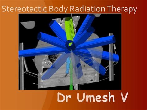 Stereotactic Body Radiation Therapy Pptx