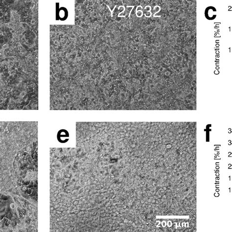 Nodule Morphologies Formed Spontaneously By Human Mpm Cell Lines In