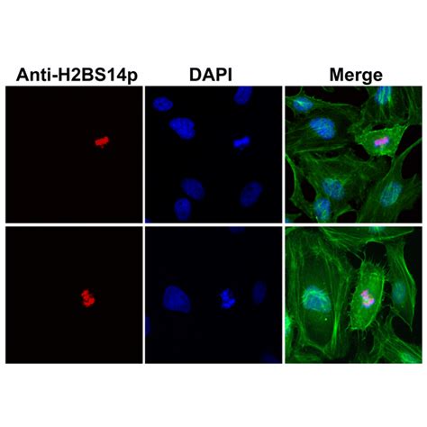 Anti Androgen Receptor Ar V7 Specific Rabbit Monoclonal Antibody