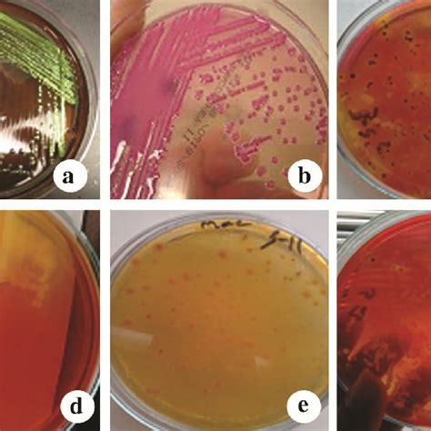 Distribution Of Bacterial Isolates Among The Study Area Download