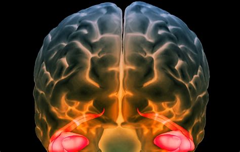 Inflammation Associated With Gray Matter Hippocampal Volume Reduction