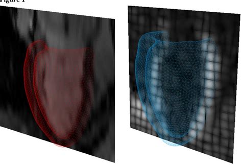 Figure 1 From Finite Element Digital Image Correlation For Cardiac Strain Analysis From 3d Whole