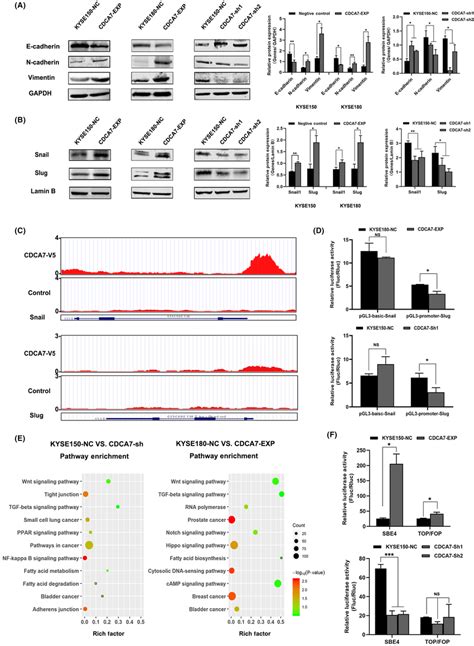 Cdca7 May Promote The Epithelialmesenchymal Transition Process Of Escc