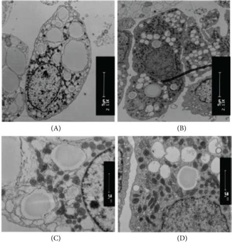 Alteration In Ultrastructural And Mass Of Adipocyte Mitochondria