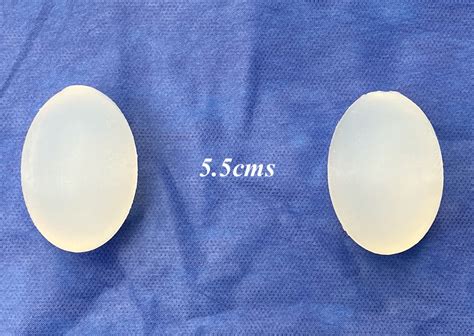 Plastic Surgery Case Study Correcting Penile Scrotal Disproportion With Custom Testicle