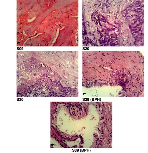 Histological Demonstration Of The General Morphology In Human Prostate