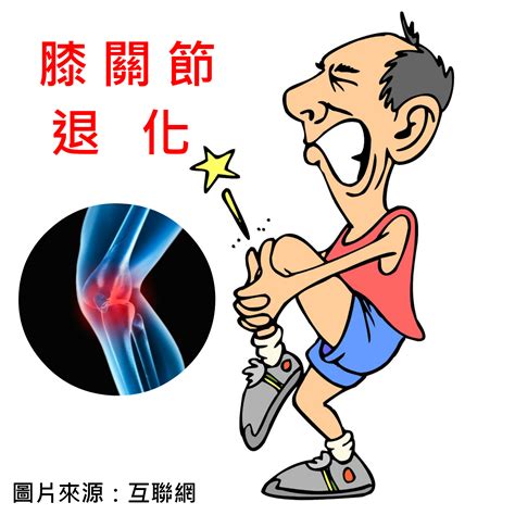膝關節退化 主頁