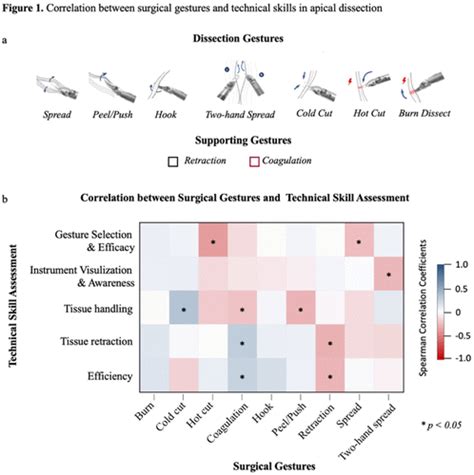 Pd30 04 Surgical Gestures To Measure Surgical Dissection Performance In Apical Dissection Of