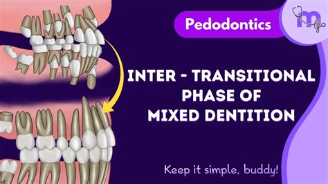Inter Transitional Phase Of Mixed Dentition Pedodontics Animated