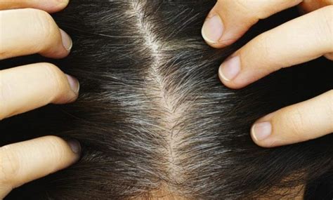 Si Të Shmangni Thinjat E Parakohshme Të Flokut Gazeta Online Insajderi