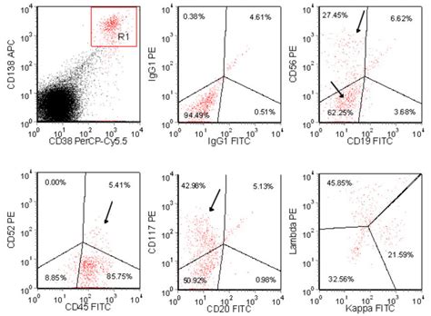 Flow Cytometric Dot Plots Showing Immunoprofile Of Bone Marrow Plasma