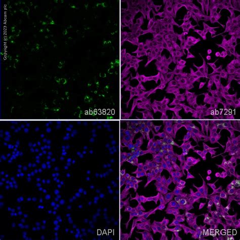 Anti Insulin Antibody Ab63820 Abcam