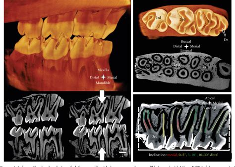 Figure 1 From Imaging An Adapted Dentoalveolar Complex Semantic Scholar