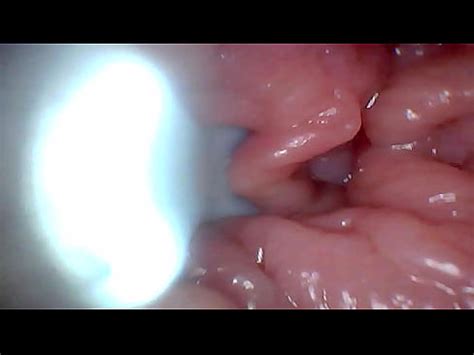 First Time An Endoscope Reveals The G Spot Up Close Without Mounting XVIDEOS COM
