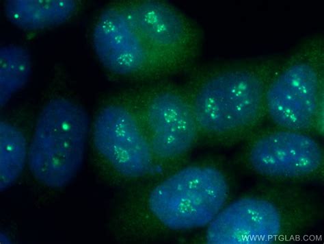 STK3 antibody (12097-1-AP) | Proteintech