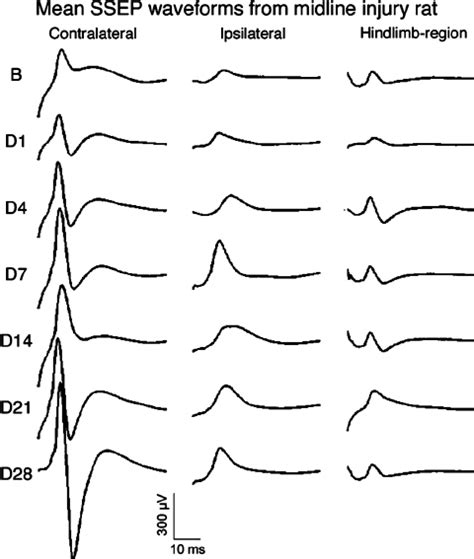 Mean Ssep Waveforms Recorded From Three Regions Of The Cortex During