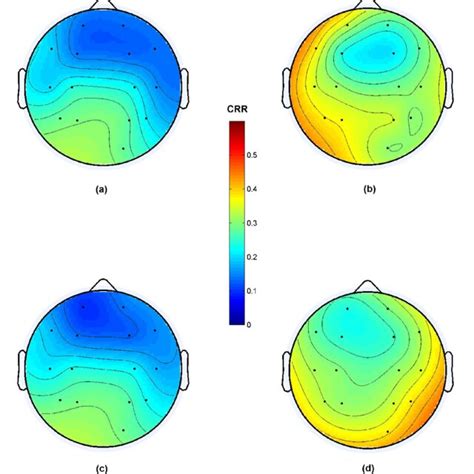 Average Scalp Topographies Of Significant Crr For Patient S4 Female Download Scientific