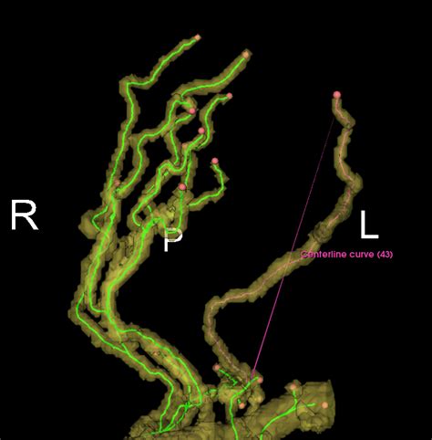 Vmtk Extract Centerline Extracts Centerline Curves With Both A Curve