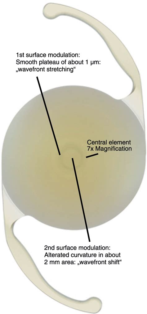 Enhanced Depth Of Focus Intraocular Lenses Through Focus Evaluation Of