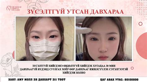 ДАРХАН ХАМГИЙН ТОМ ЗАРЫН ГРУПП