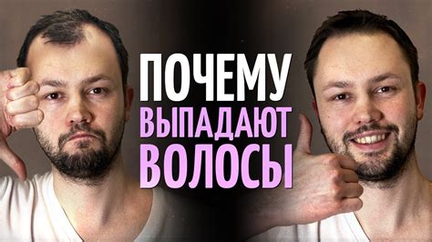 Почему выпадают волосы Врач косметолог о причинах облысения Youtube