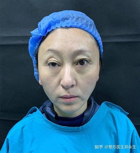 年纪大就别想着修复整形了？这位求美者的经历，让她活出自信人生 知乎