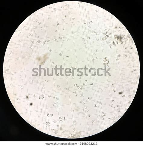 Erythrocytes Under Microscope They Appear Biconcave Stock Photo Shutterstock