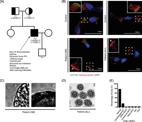 Biallelic Variants In Cep164 Cause A Motile Ciliopathy‐like Syndrome