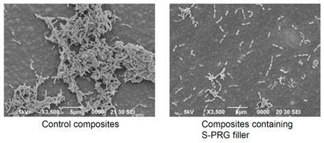 Multiple Ion Releasing Bioactive Surface Pre Reacted Glass Ionomer S Prg Filler Innovative