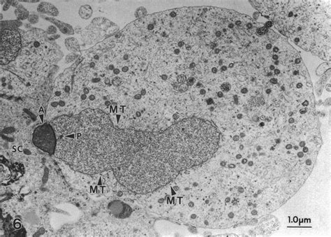 Electron Micrograph Of A Step 5 Spermatid The Nucleus Is Roughly