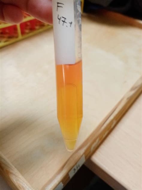 What Is The Purpose Of Phenol Red In The Carbohydrate Fermentation Test