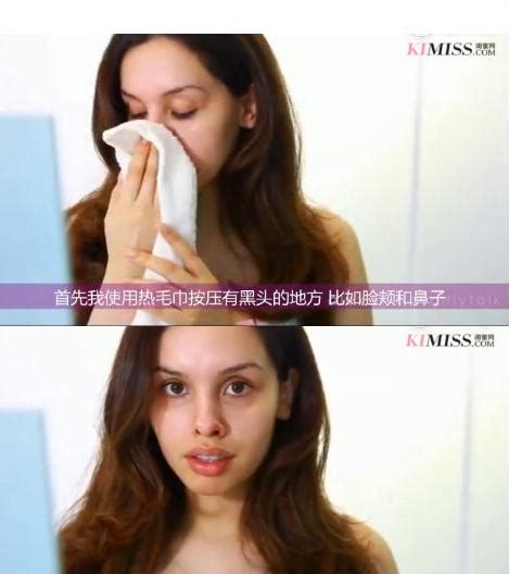 教你輕鬆安全擠出黑頭 每日頭條