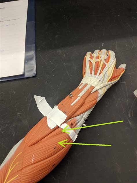 Is This Extensor Carpi Radialis Longus Brevis R Anatomy