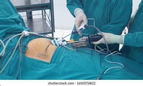 590 Cholecystectomy Images Stock Photos Vectors Shutterstock