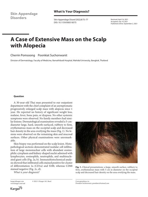 A Case Of Extensive Mass On The Scalp With Alopecia Request Pdf