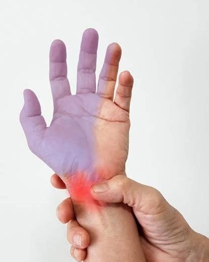 عيادة هل تعاني من الم وتنميل في كف اليد بالذات اثناء الليل ومش عارف تعمل حاجه 👇👇 علاجاختناق