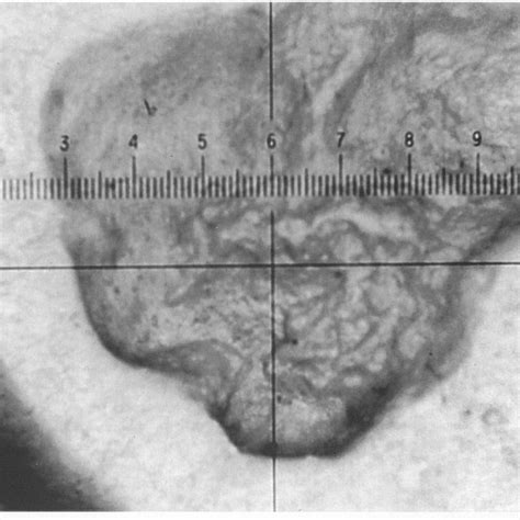 Positive Cast Of Type Iii Open Simple Twining S Twisted Weft Download Scientific Diagram